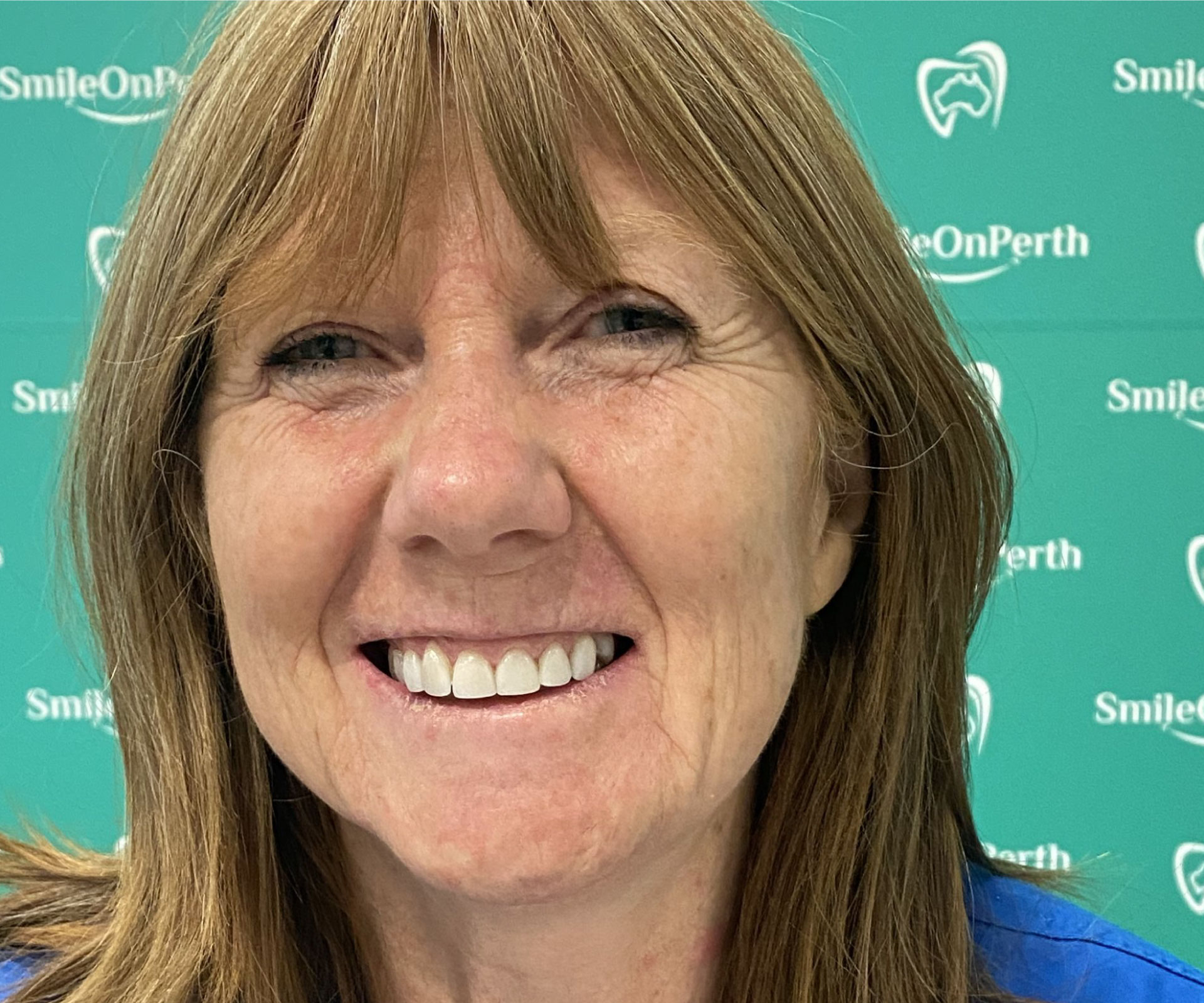 Cosmetic Dentist | SmileOn Perth