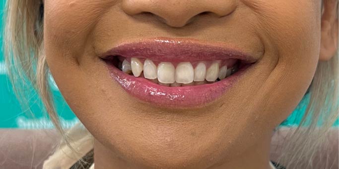 Our Work | Smileon Perth