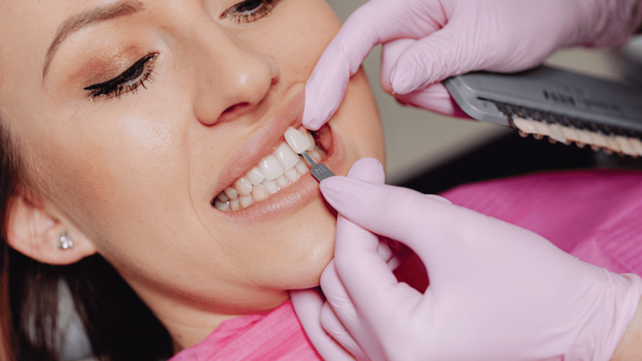 Dental Crowns Explained: Varieties, Procedures, and Aftercare