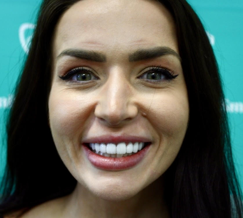 Cosmetic Dentist | SmileOn Perth